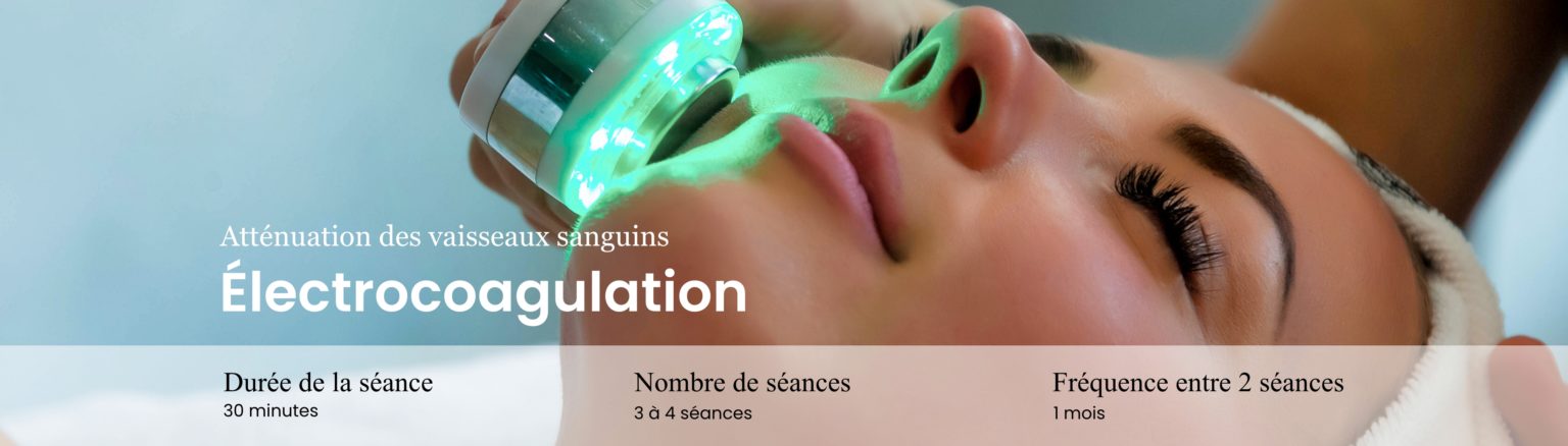 LA THERMOCOAGULATION VASCULAIRE - ARTHESTIC