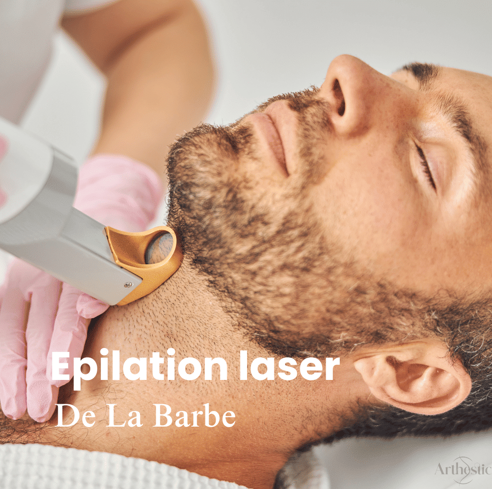 Épilation laser barbe - ARTHESTIC